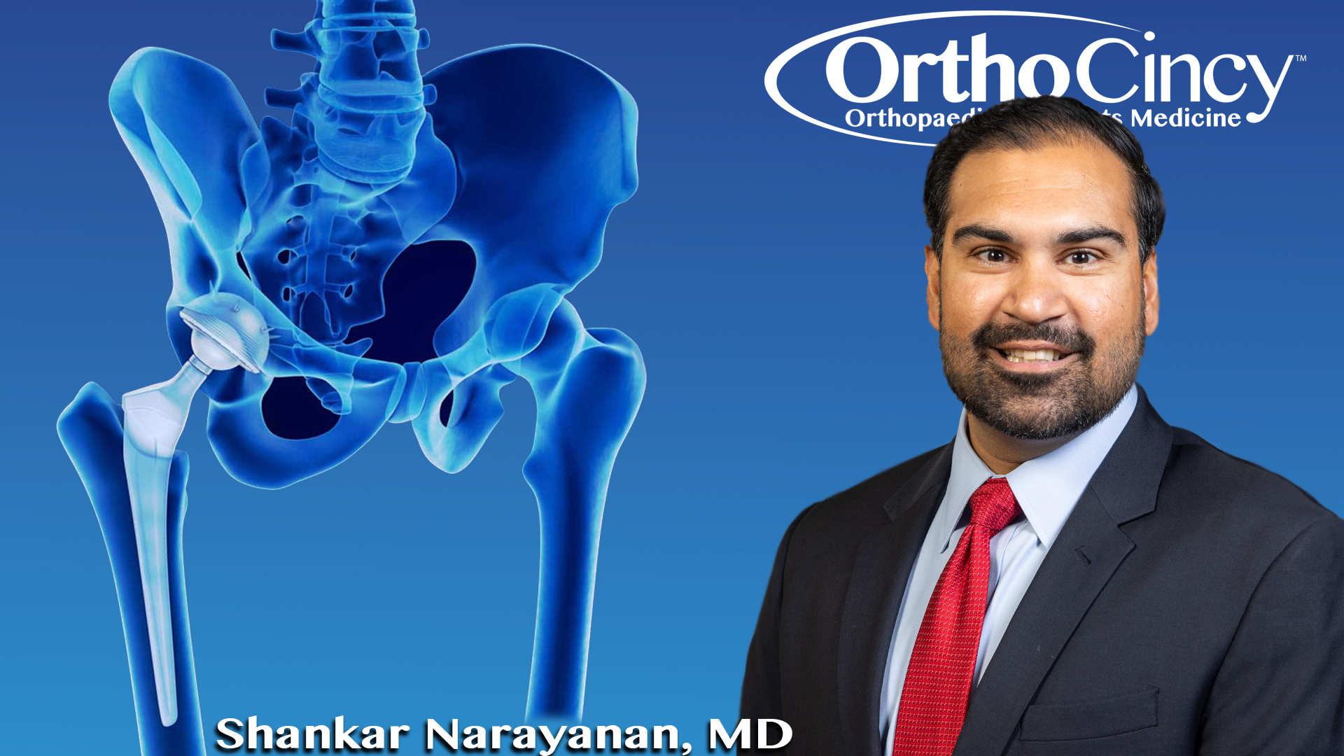 Dr. Shankar Narayanan - Hip Seminar "The Future of Total HIP Replacements: A History Lesson ...