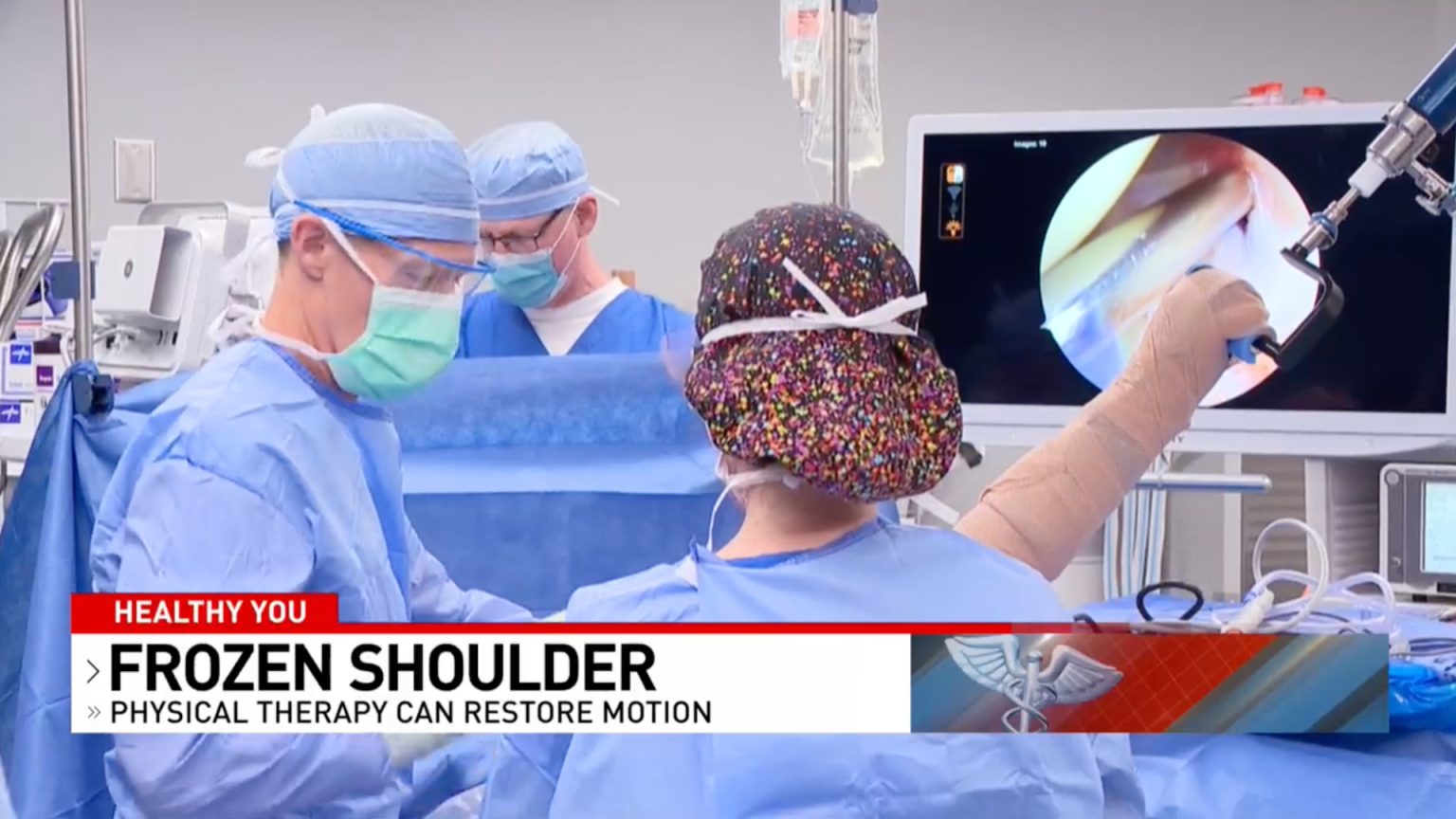 Frozen shoulder: according to orthopedic experts, common condition ...
